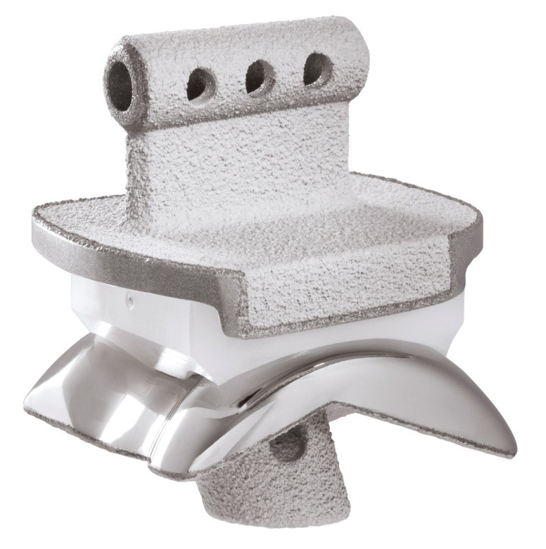 Prothèse totale de cheville - Union Cheville Pied